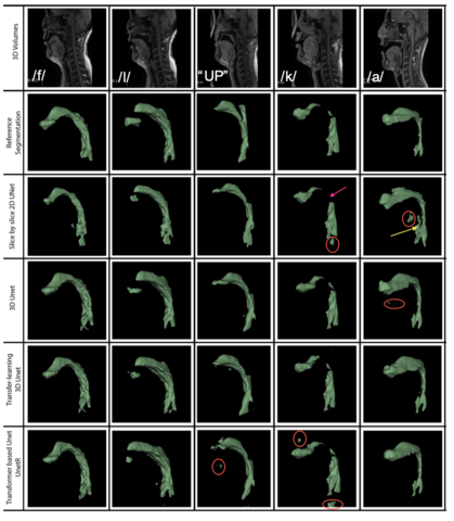 Manuscript on deep learning methods for vocal tract MRI segmentation accepted in Journal of ...